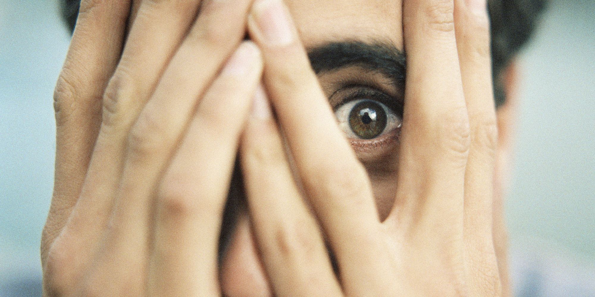 dermatite seborroica – Ddi